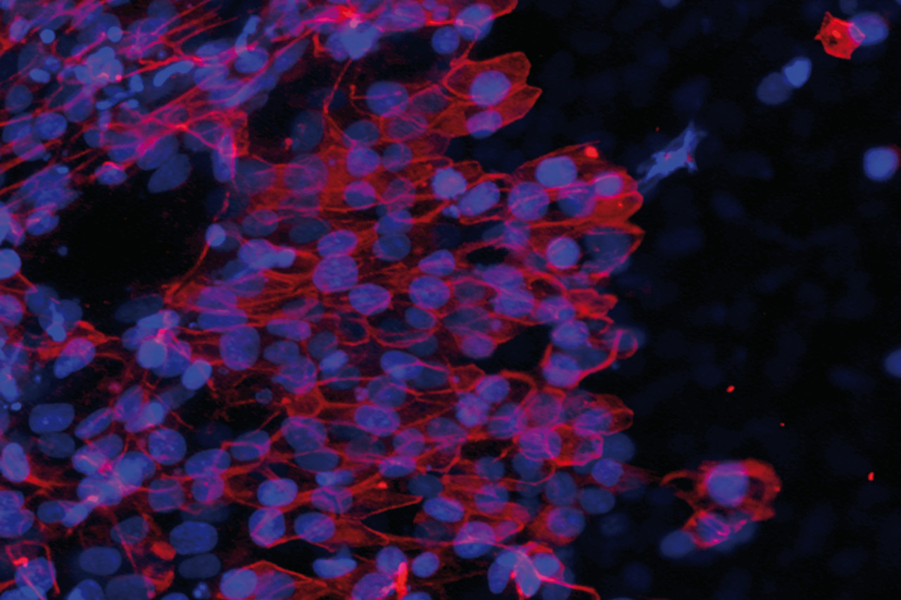 [LUM#6] Le corps réparé - Université de Montpellier